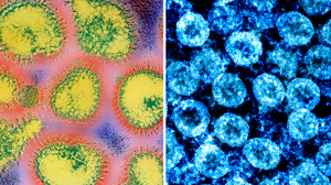 The Coronavirus Crisis : NPR