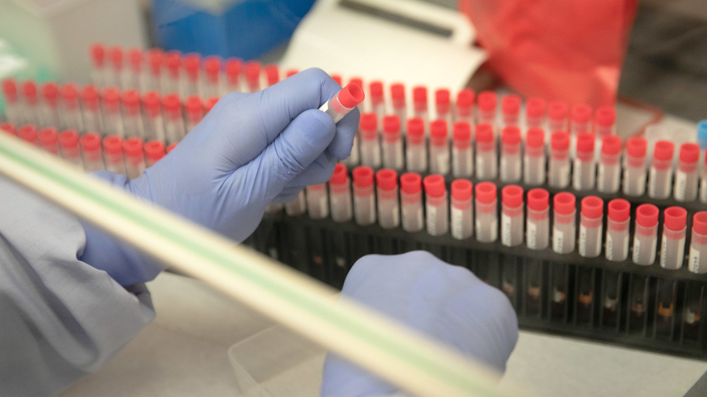 Universities Revamp Science Labs for Coronavirus Testing : Coronavirus ...