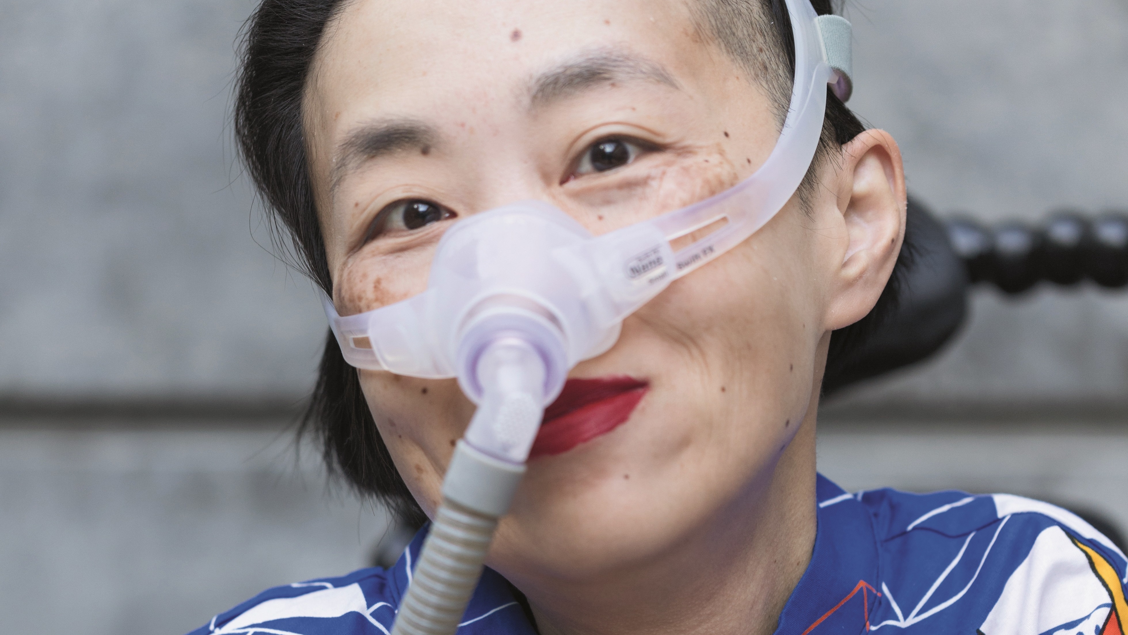 People With Disabilities Say Medical Biases Make Them Fear Pandemic ...