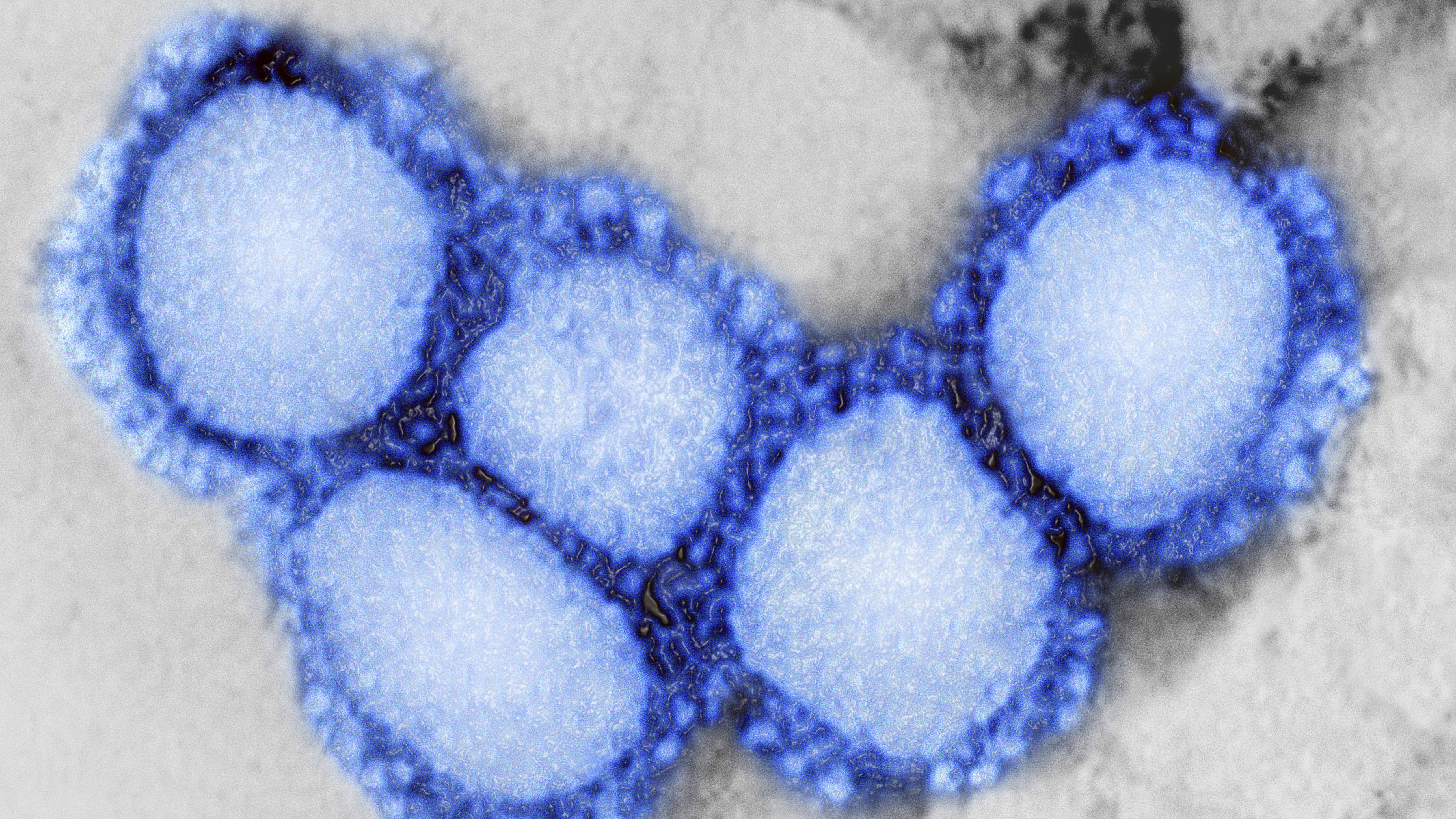 Medical Historian Says Pandemics Are 'Looking Glasses' For Societies ...