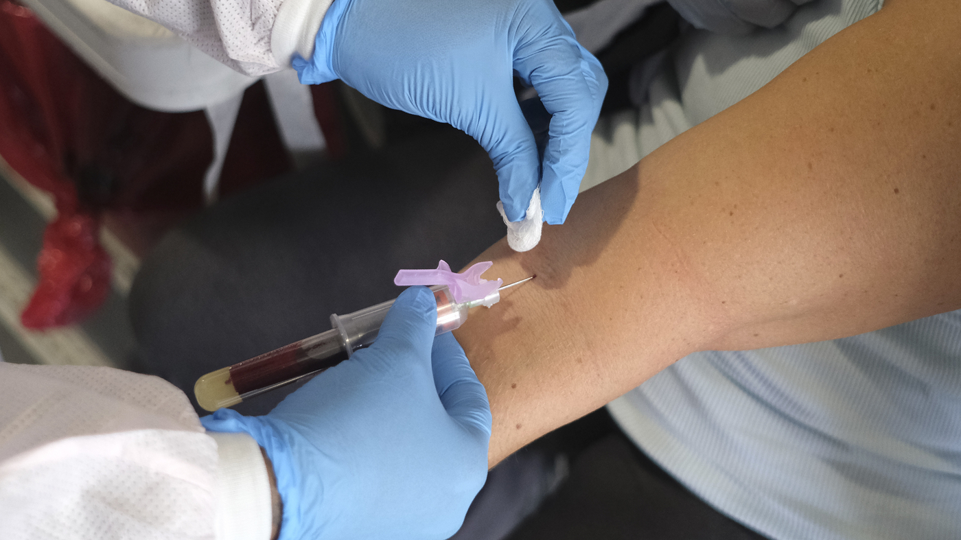 Coronavirus Antibody Tests: FDA Raises Standards : Shots - Health News ...