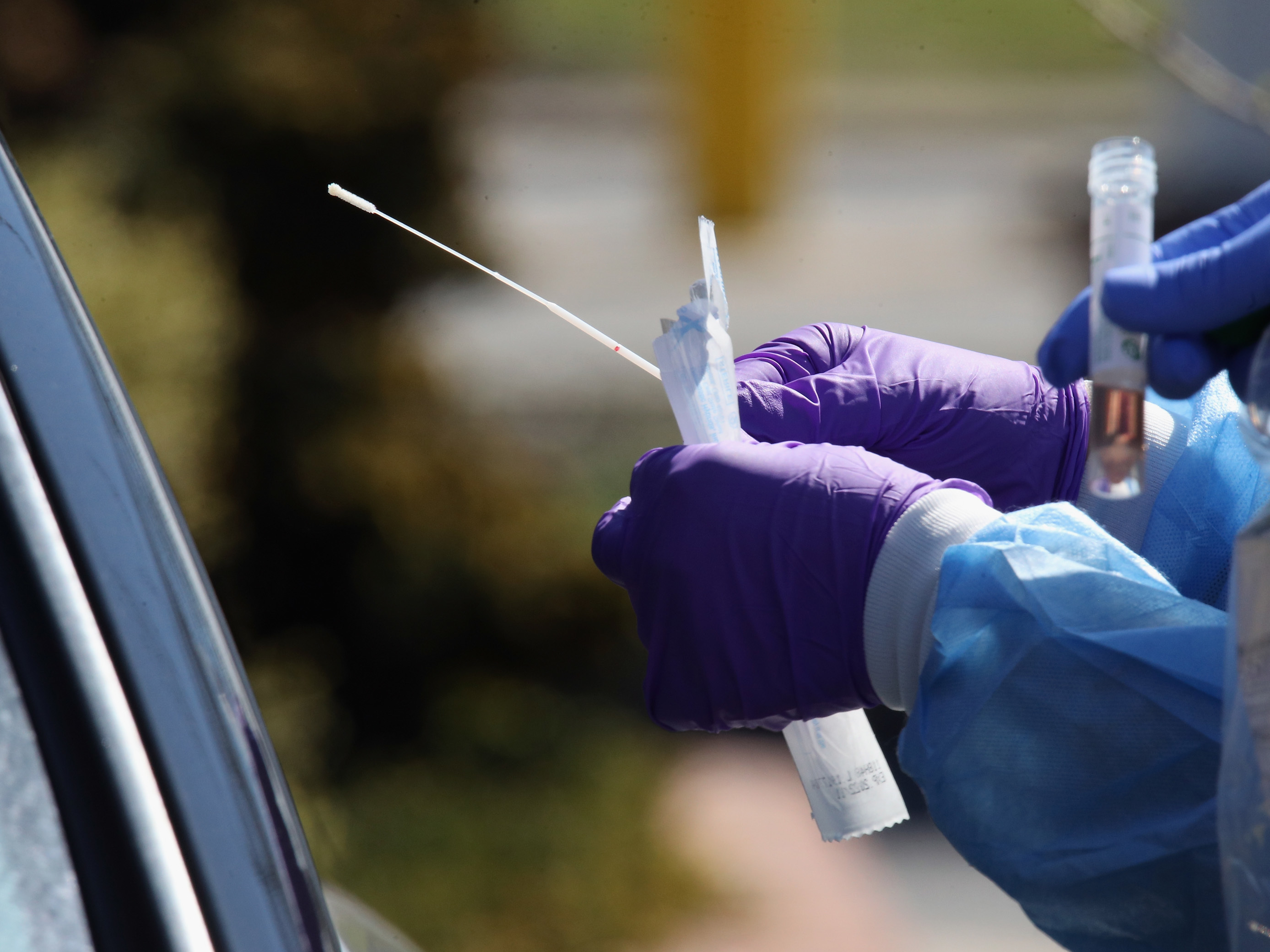 Despite Early Warnings, U.S. Took Months To Expand Swab Production For ...