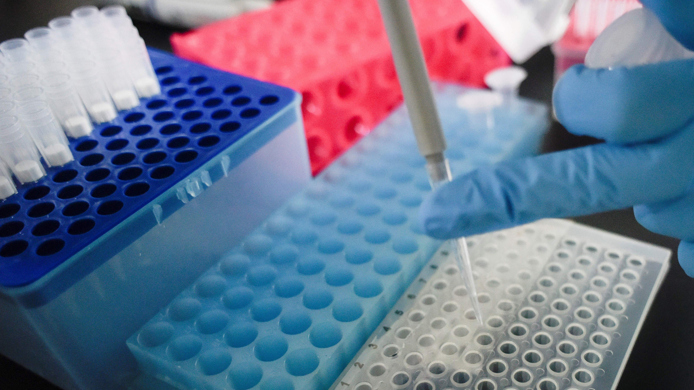 Scientists Researching Coronavirus Build Bridges Around World : Shots ...