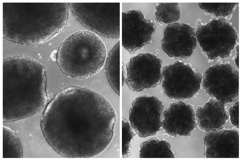 With Link: Neanderthal DNA Spliced Into 'Minibrains' Yields Clues About ...