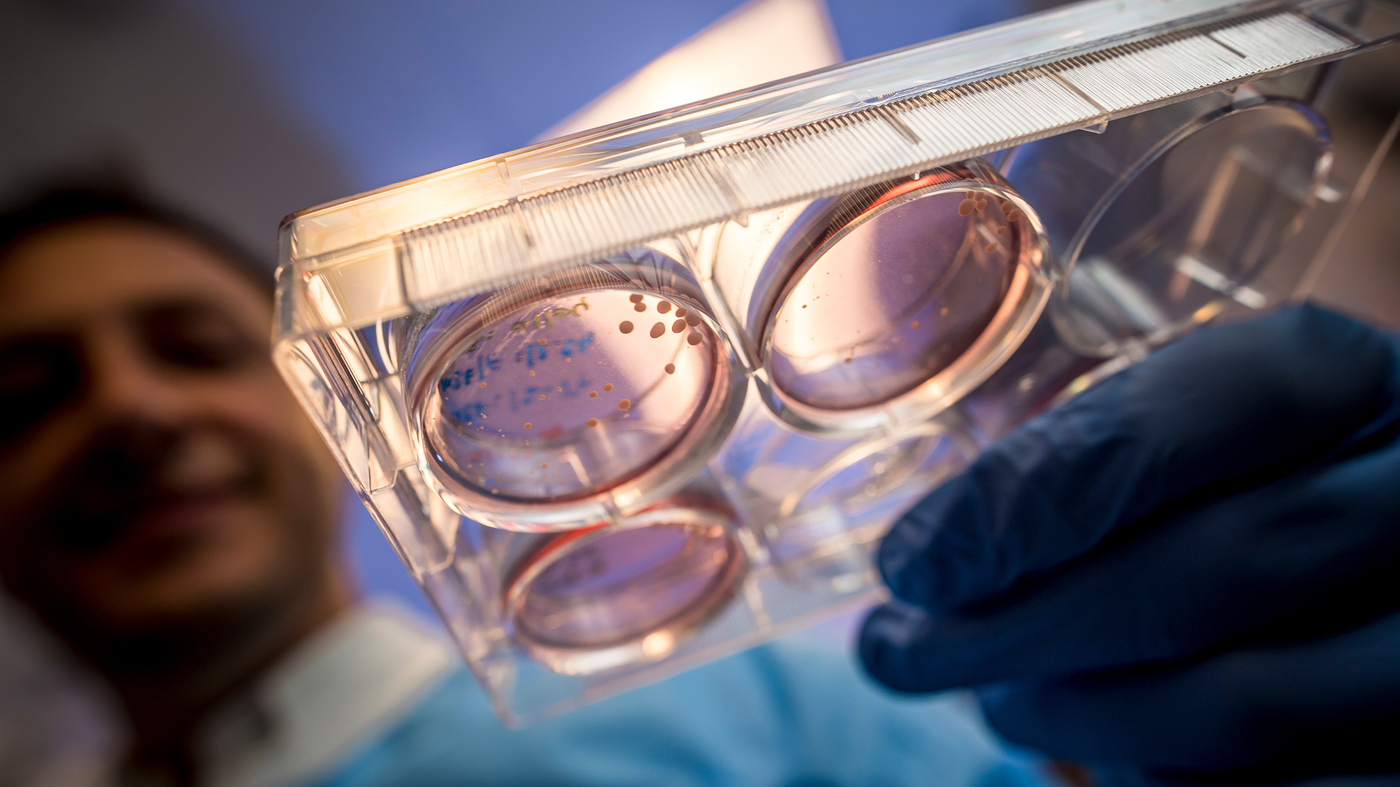 Neanderthal DNA Spliced Into 'Minibrains' Yields Clues About Human ...