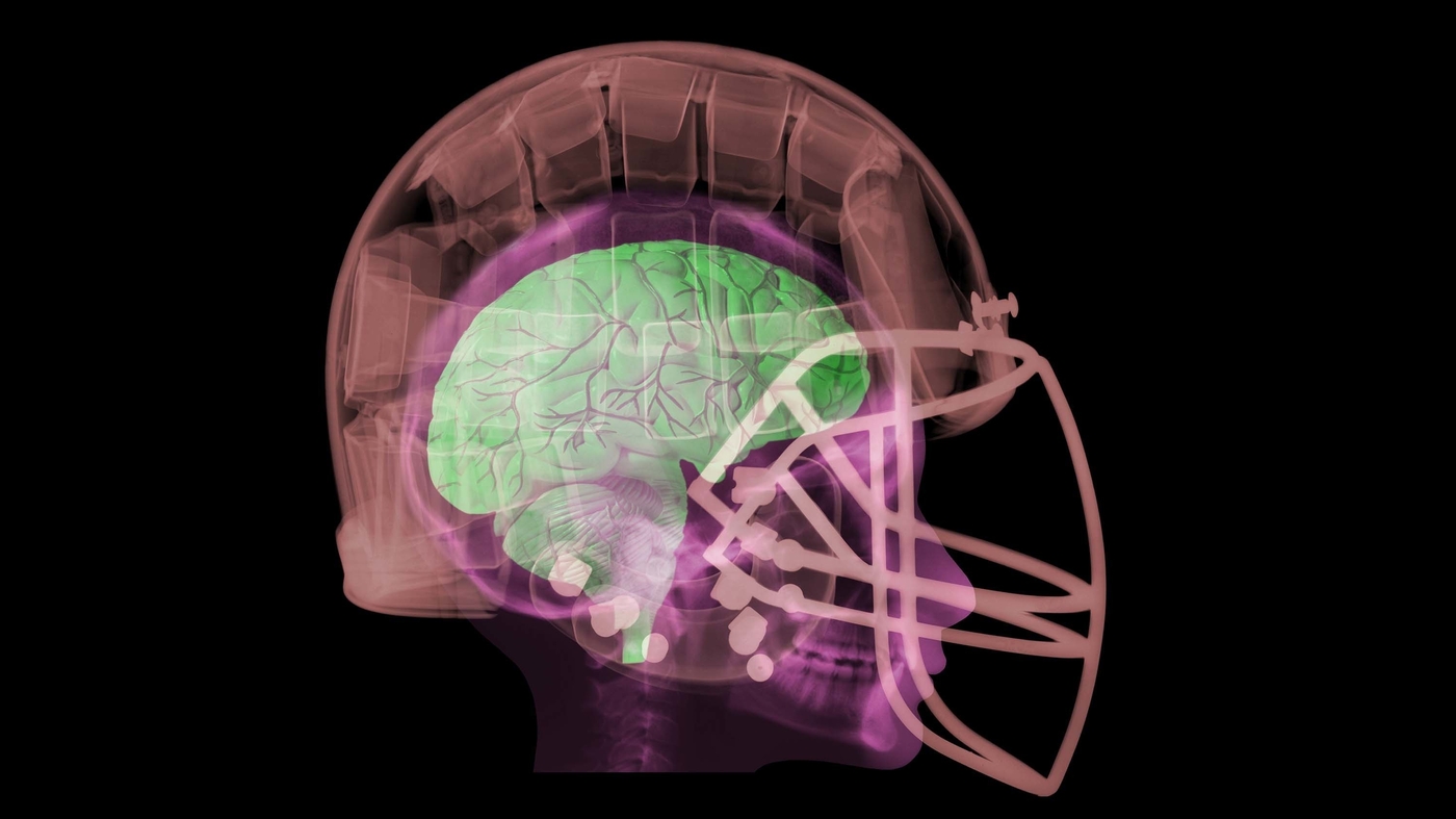 Concussions, Sound, and The Brain : Short Wave : NPR