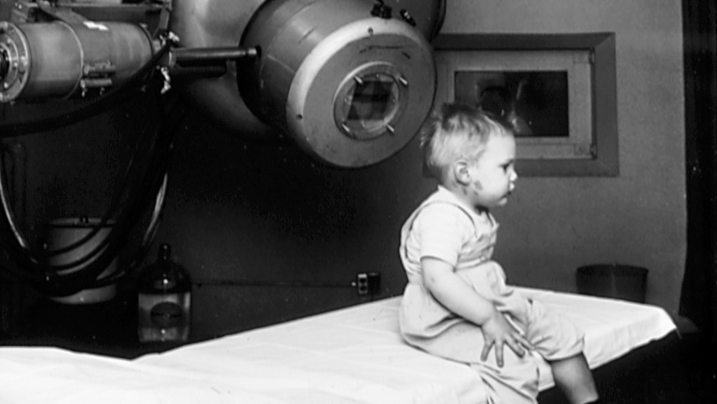 The first cancer "moonshot" actually launched 50 years ago : Shots ...