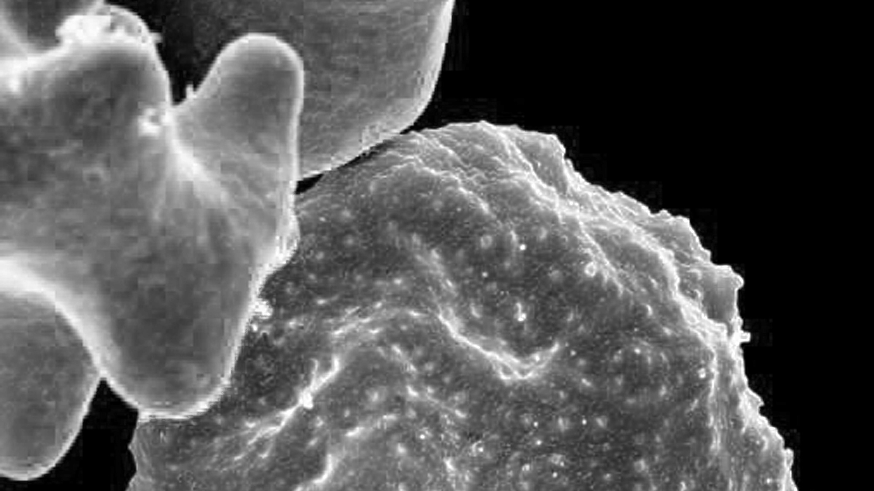 Drug-resistant malaria is emerging in Africa. Is the world ready ...