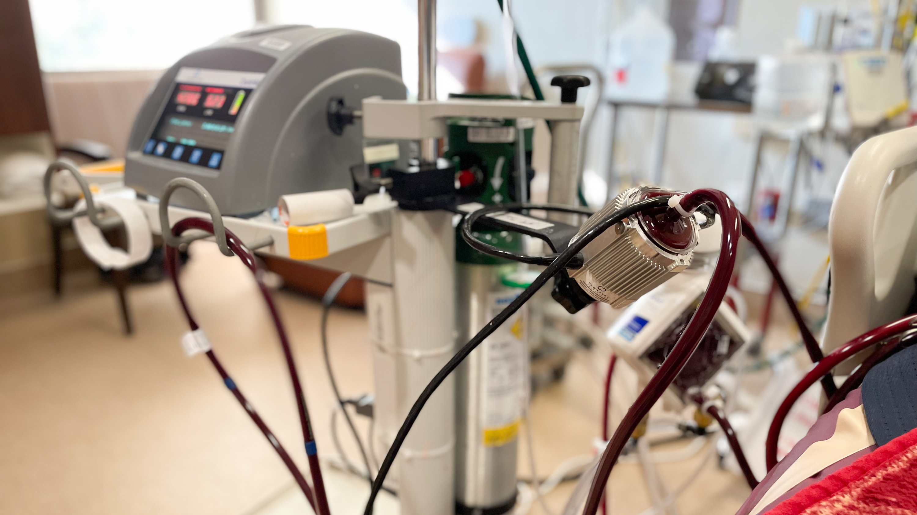 ECMO machine shortages cost lives, study finds : Shots - Health News : NPR
