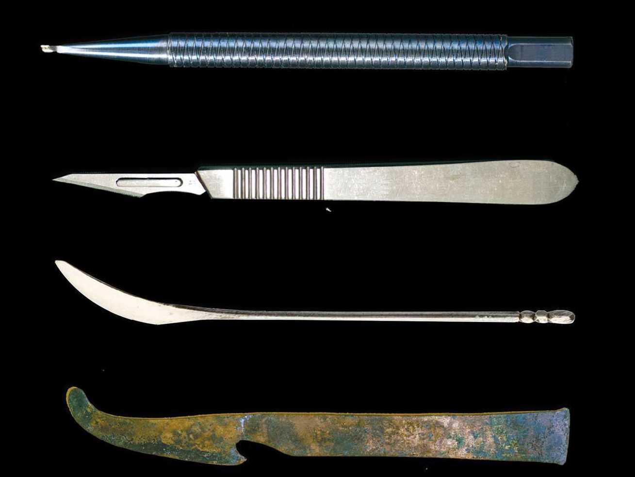 Stone Age brain surgery? It might have been more survivable than you ...