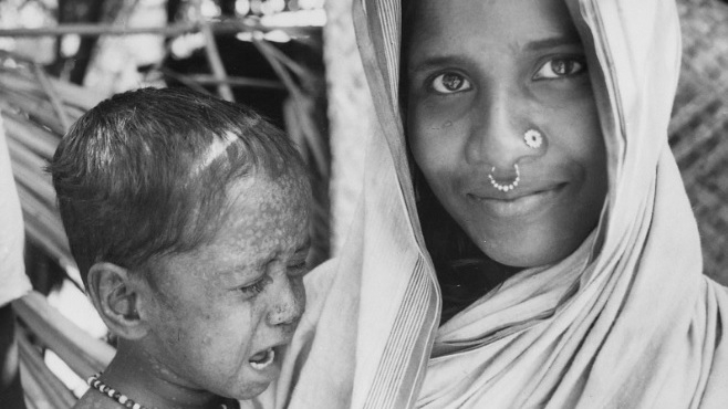 Rahima holds a special place in smallpox history, years after it was ...