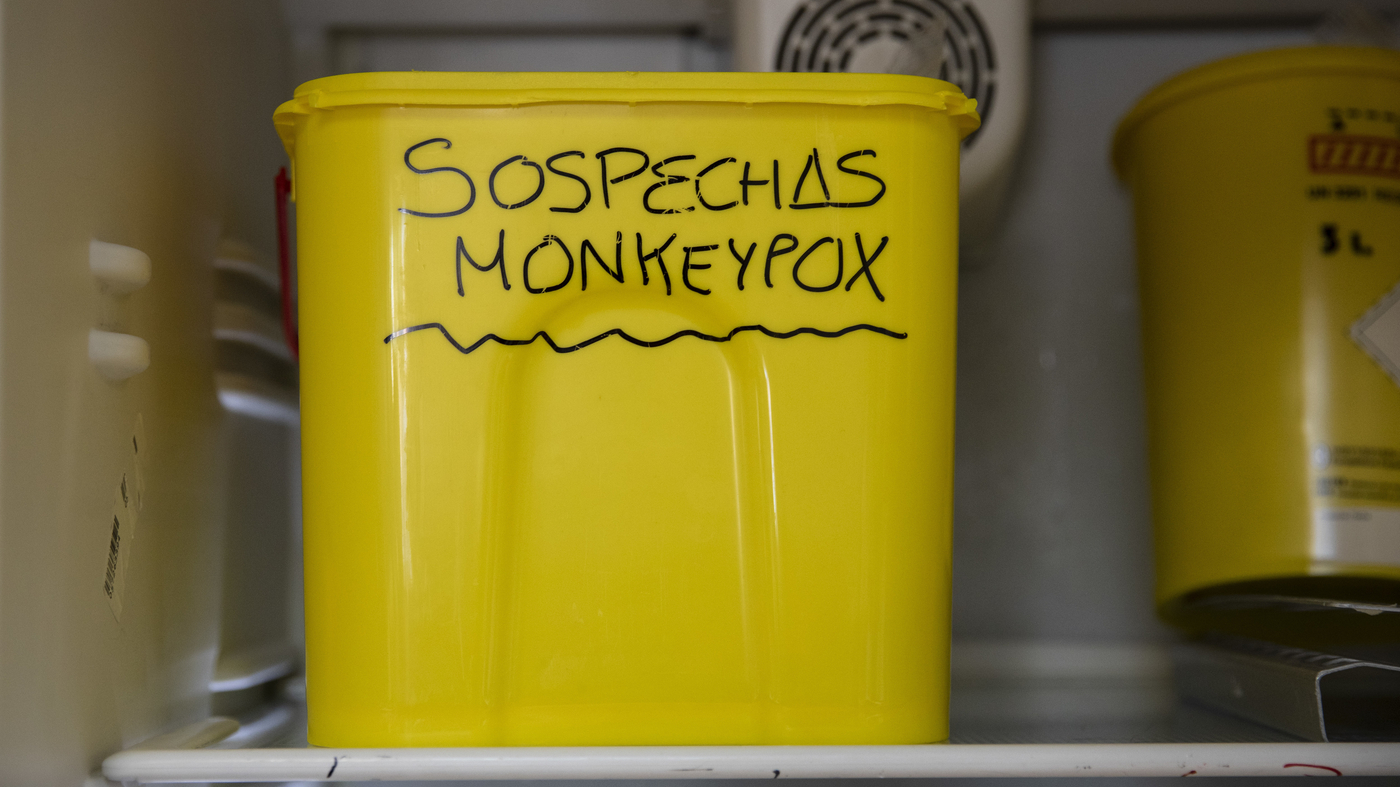Monkeypox outbreak was avoidable and we ignored the warning signs ...