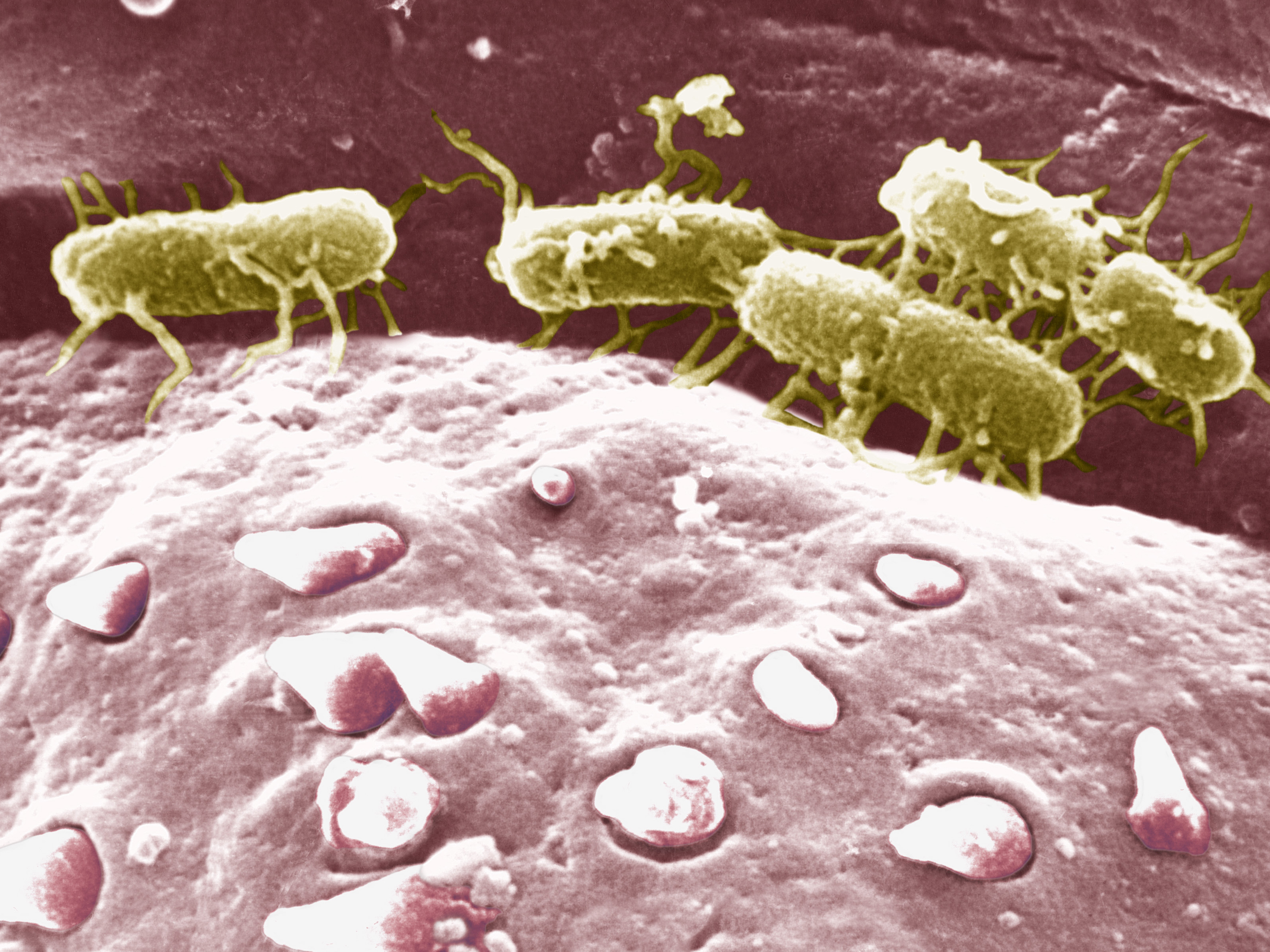 Typhoid mutated to beat antibiotics. Science is learning how to beat ...