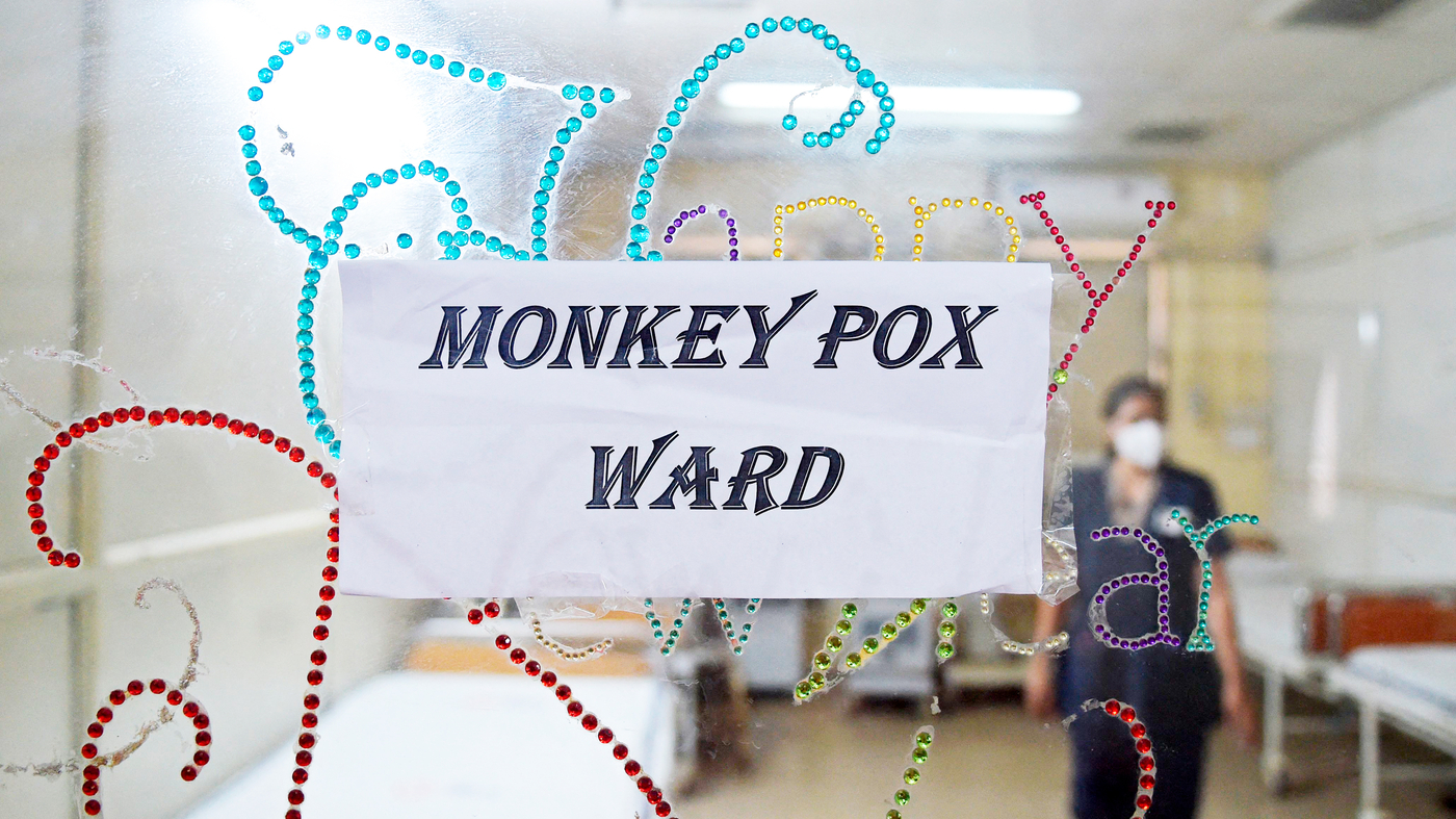 How contagious is monkeypox? If you had chickenpox are you safe? Do ...