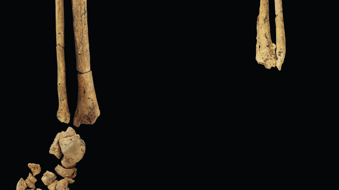 A 31 000 Year Old Skeleton Reveals The Oldest Evidence Of An Amputation