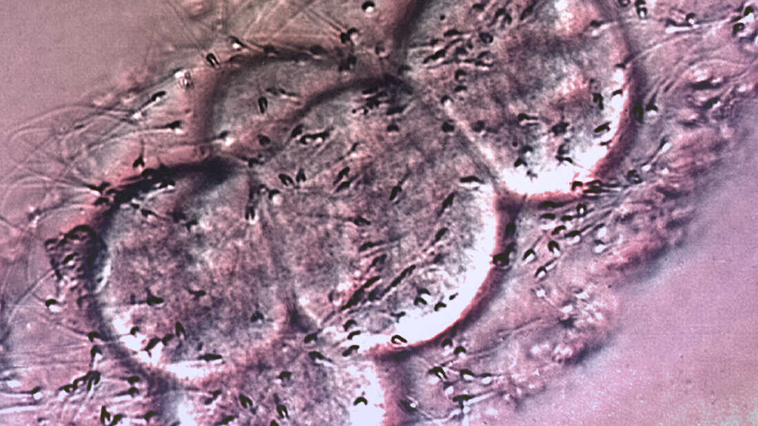 The Science of In Vitro Fertilization (IVF) : Short Wave : NPR