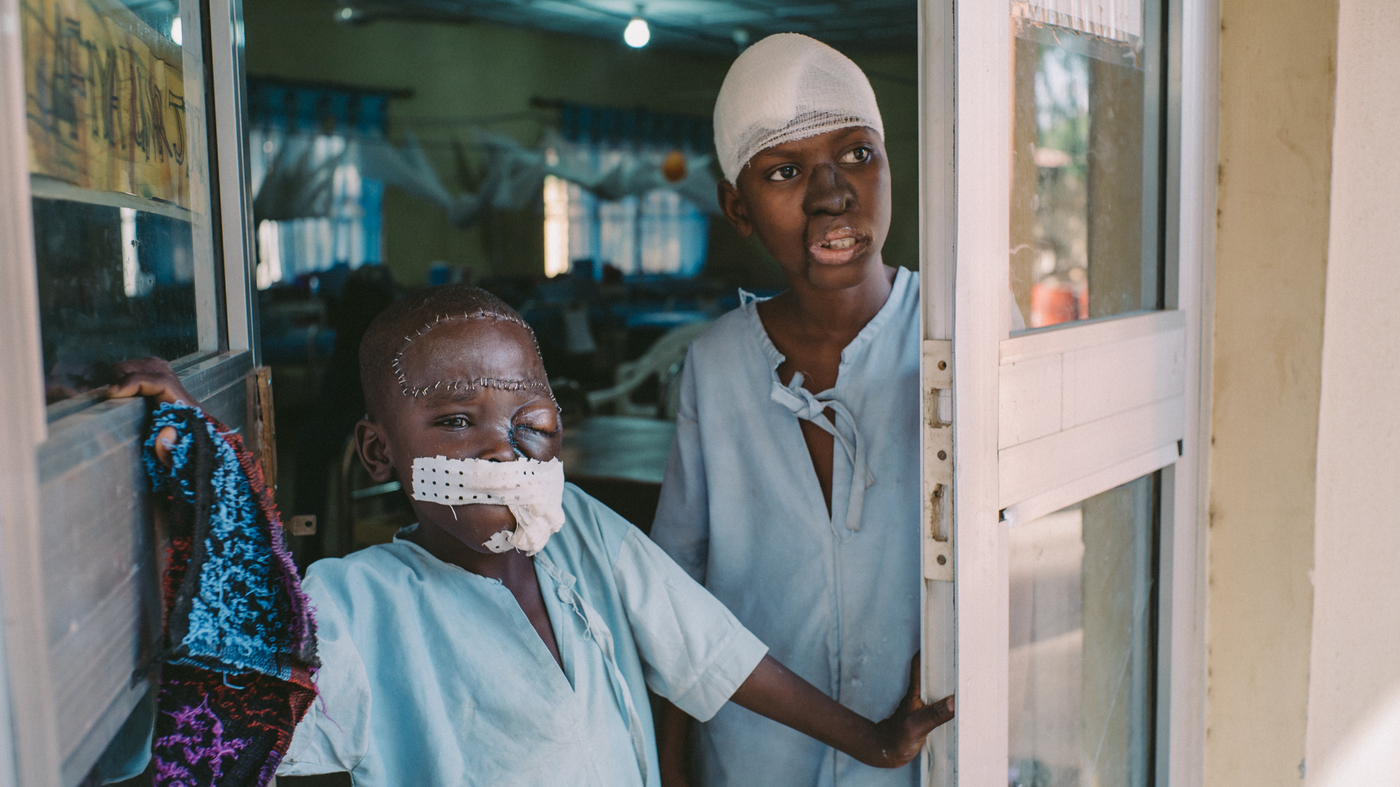 Seeking help to fight noma, a deadly disease many doctors haven't even ...