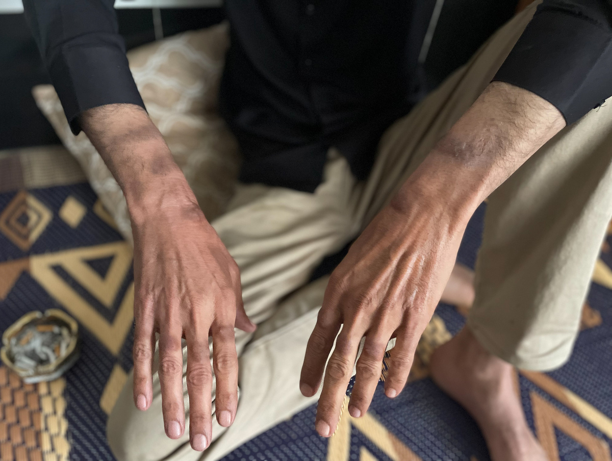 U.S. abuse and horrid photo in Abu Ghraib left his life still ruined ...