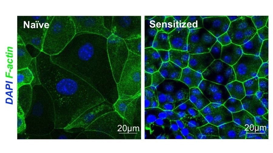 For the millions who get recurring UTIs, a breakthrough sheds light on ...