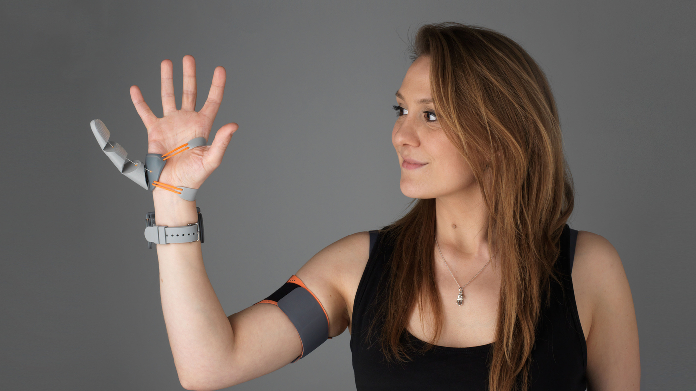 Prosthetic third thumb reshapes the body and mind : Short Wave : NPR
