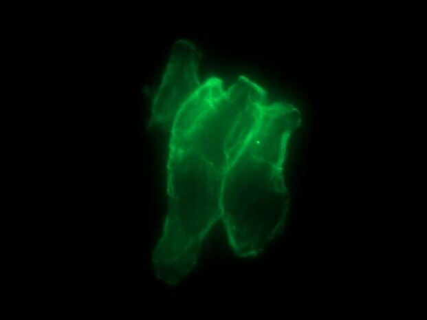 Long COVID research after the public health emergency ends : Short Wave ...