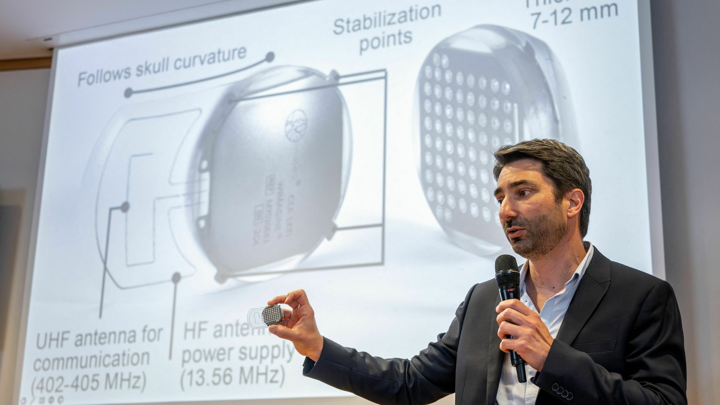 Helping a man walk again with implants connecting his brain and spinal ...