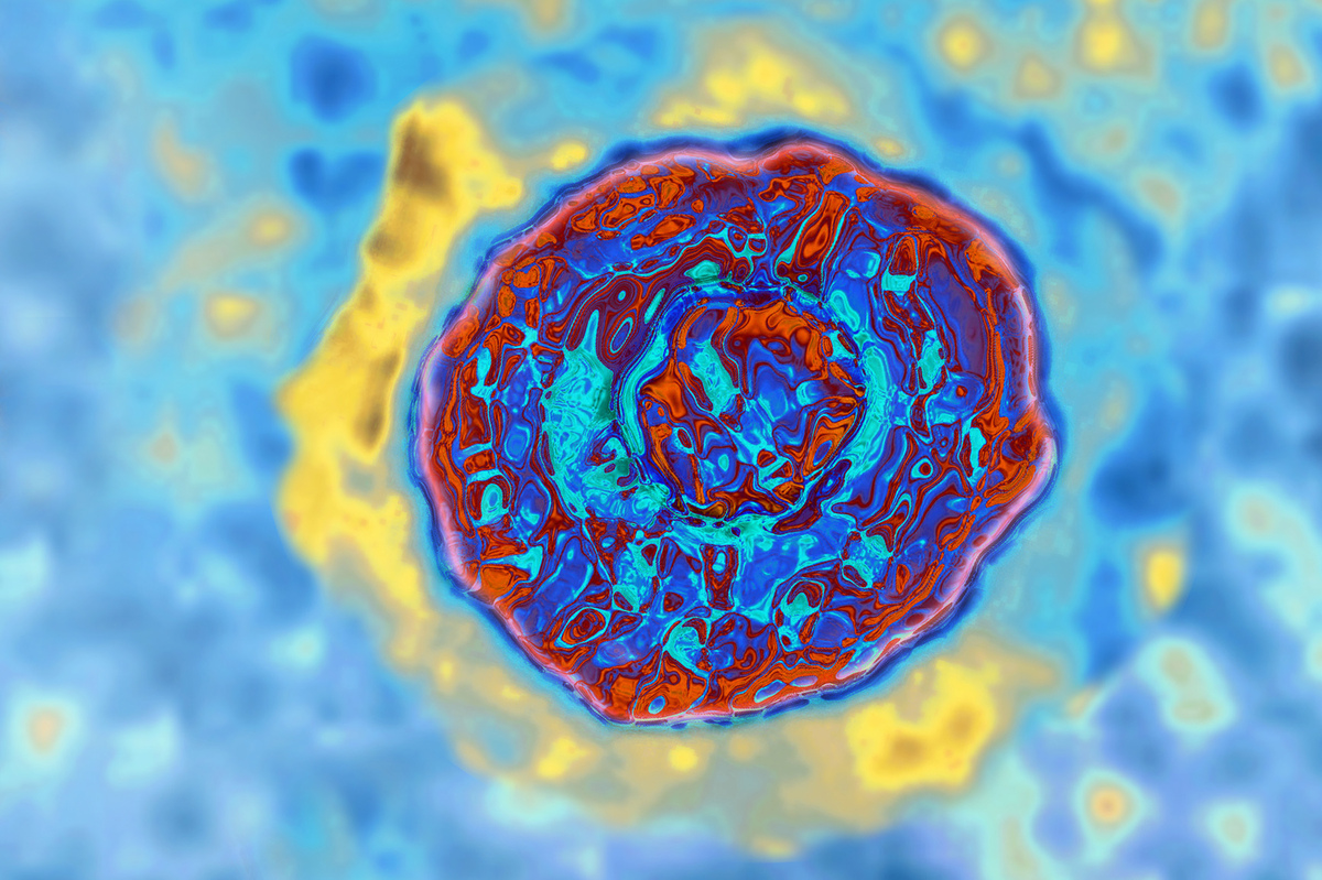 Now we know hep C's secret strategy to hide from the immune system ...