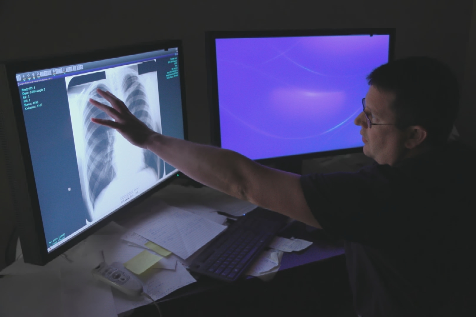 As coal miners suffer and die from severe black lung, a proposed fix ...