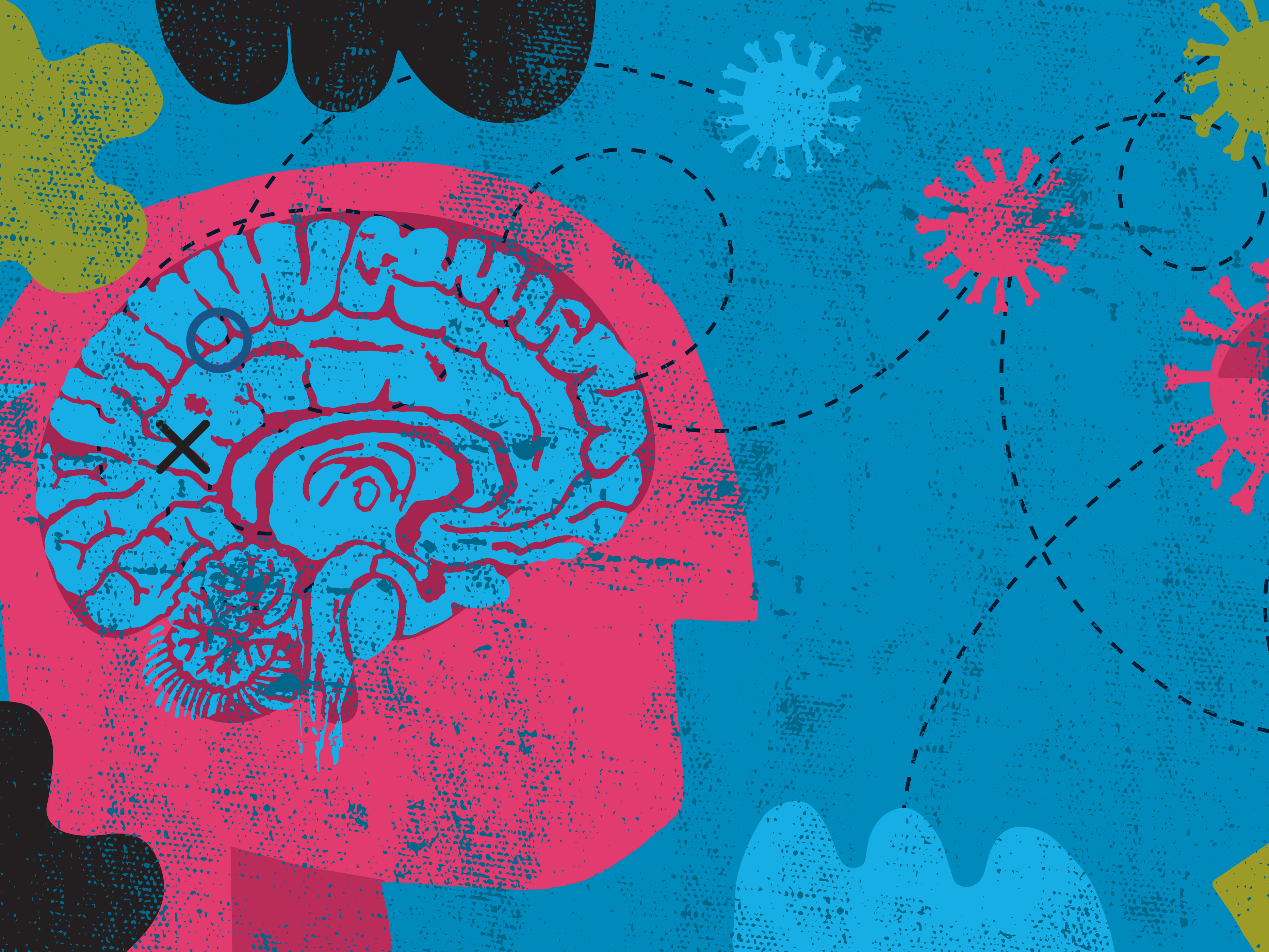 Pain, fatigue, fuzzy thinking: How long COVID disrupts the brain | NCPR ...