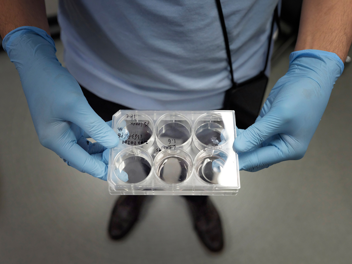 A look at the international race to create human eggs and sperm in the ...