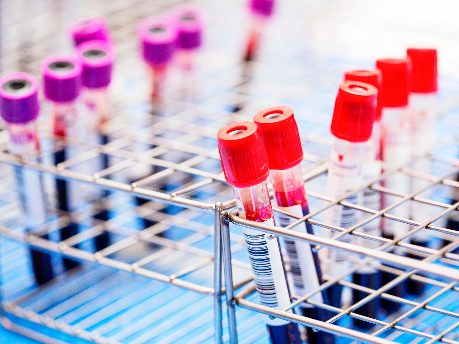 A simple blood test can detect colorectal cancer early, study finds ...