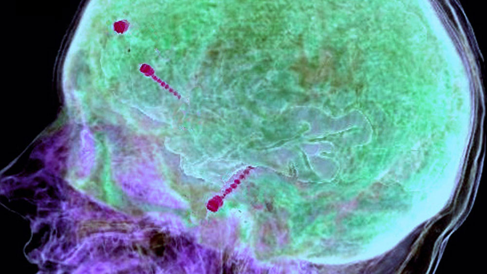 In Milliseconds, Brain Zips From Thought To Speech : NPR