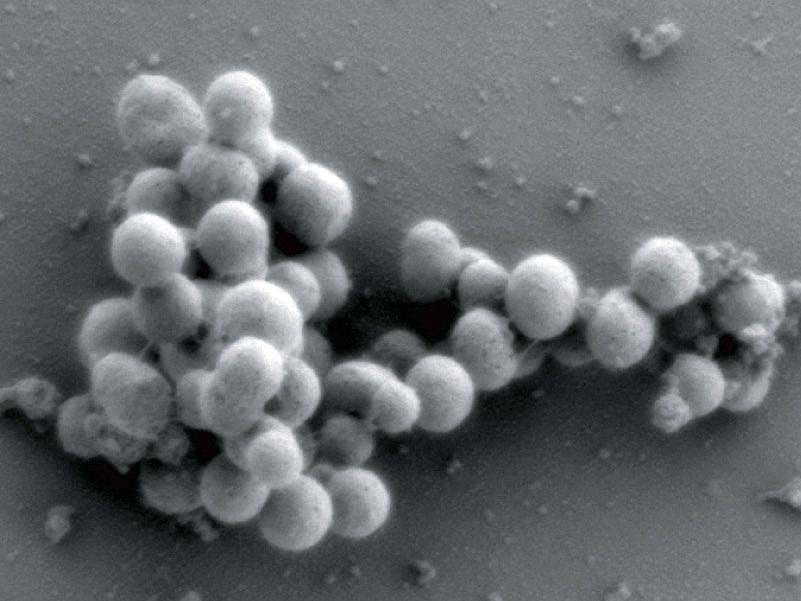 Artificial life at last – Family Inequality