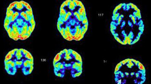 Inside The Criminal Brain : NPR