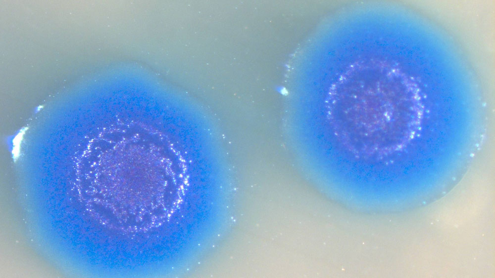 DNA Transplant Transforms Bacteria : NPR