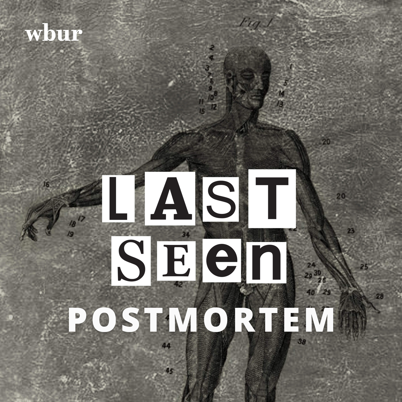 Last Seen : NPR