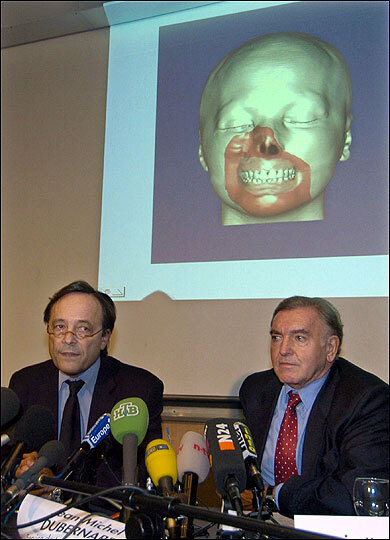 French Doctors Perform First Partial Face Transplant : NPR