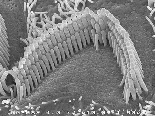 Protein Key to Human Hearing Discovered : NPR