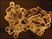 Update: Searching for Source of E. Coli Outbreak : NPR