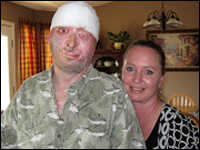 Burned Soldier Continues Long Road To Recovery : NPR