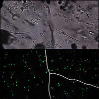 Snow Flurries, Bacteria Likely : NPR