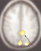 Study Sheds Light on Compulsive Hoarding : NPR