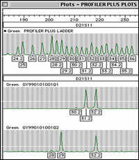 FBI's New Technology Revolutionizes DNA Analysis : NPR